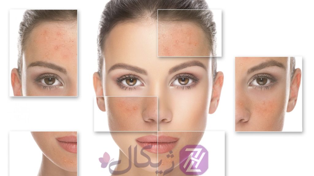 کوکتل ضد لک و سفید کننده ووگ Vogue Whitening فروشگاه ژیکال